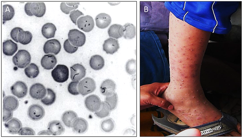 رده‌بندی حشرات- حشره‌شناسی پزشکی- زئونوز